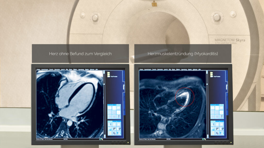 Herz-MRT (Kardio-MRT) - ALTA Klinik
